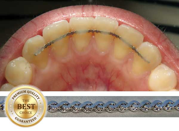 IOS Ortho. IOS Ortho. Ultra-Flex Retainer compatible Reliance Ortho ...