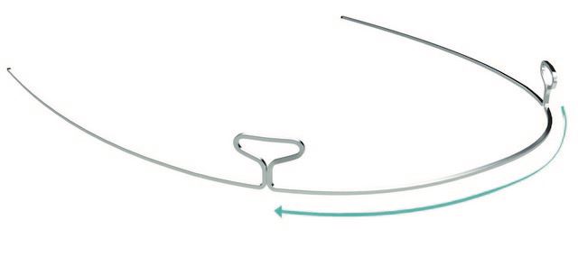 IOS Ortho. 2-Keyhole SS Wire .019 X .025 42 mm - PK/10